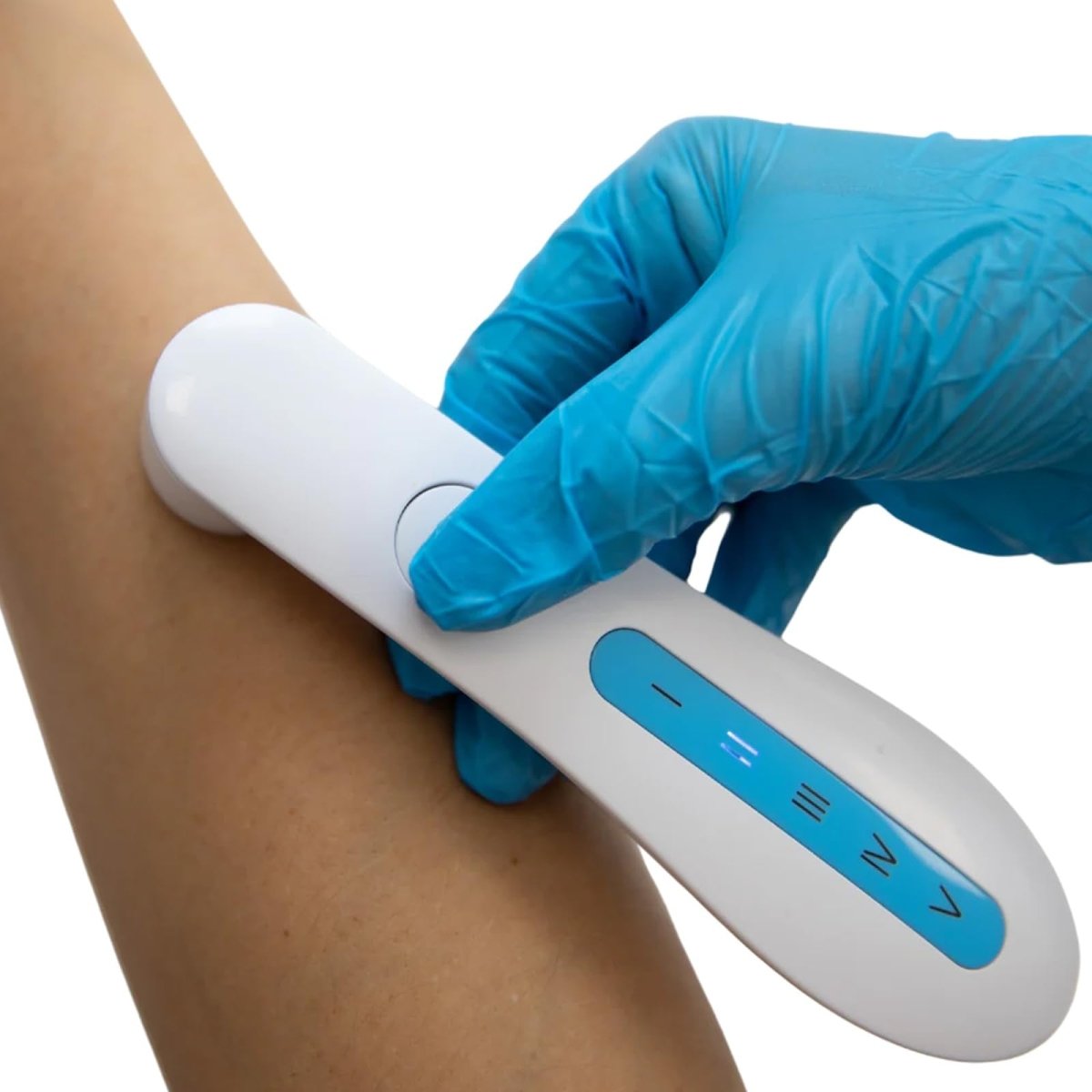 Skin Type Digital Tester, Smart Fitzpatrick Scale Skin Analyzer ...